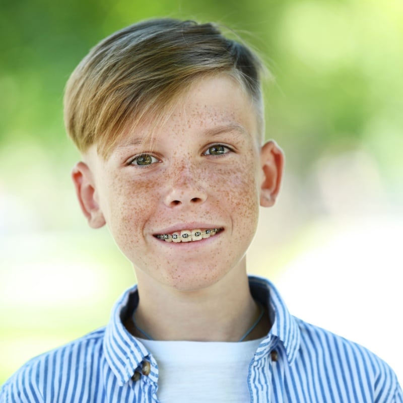 Quality Traditional Metal Braces in Lufkin and Nacogdoches